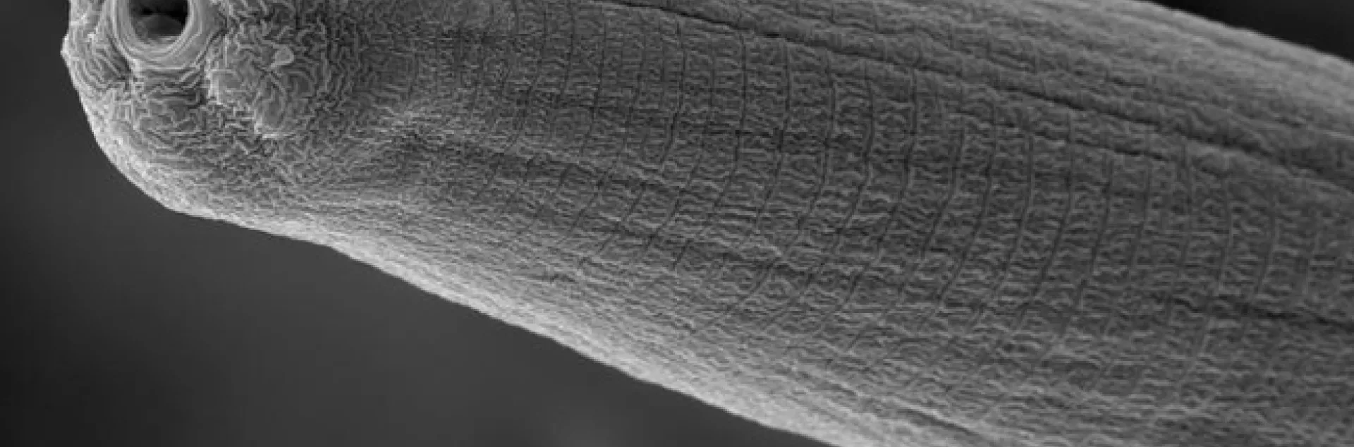 These Microscopic Parasitic Nematodes or Round Worms Spit Venom | UC ...