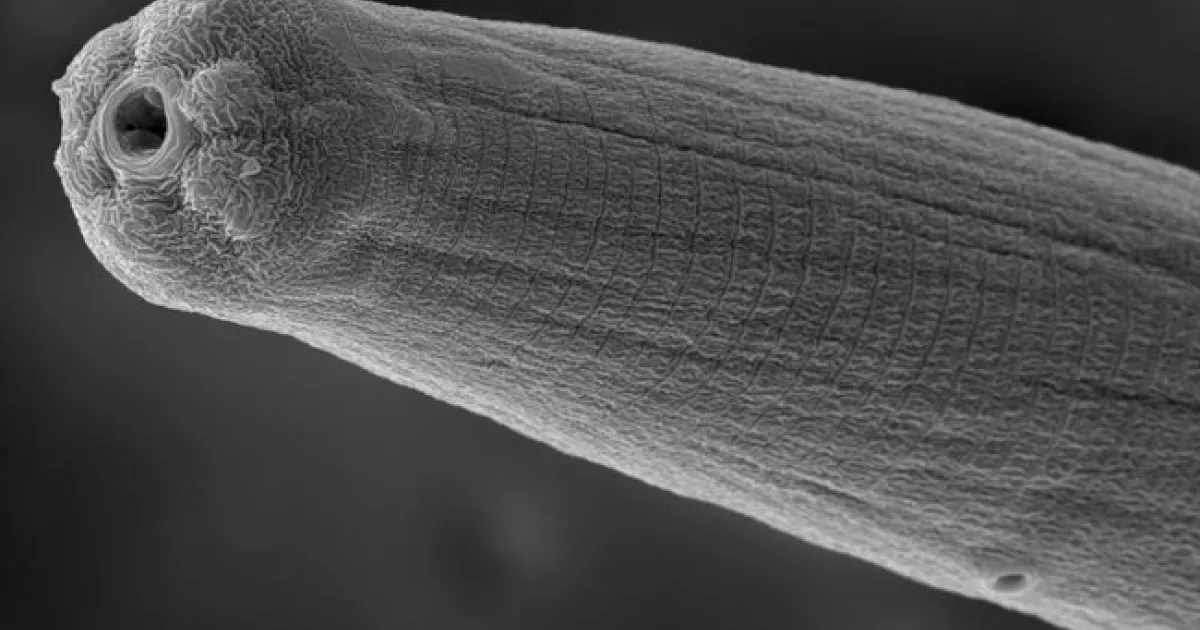 These Microscopic Parasitic Nematodes or Round Worms Spit Venom | UC ...